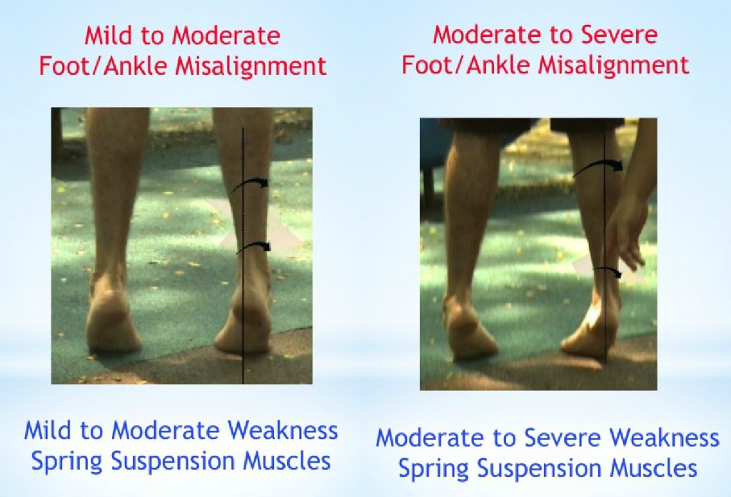 Video Tutorial #201 Can You Pass The Foot Ankle Toe Raise Alignment ...