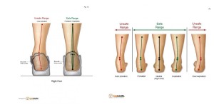 Heel Spurs – Self Help Tips, Treatment and Prevention From The Barefoot ...